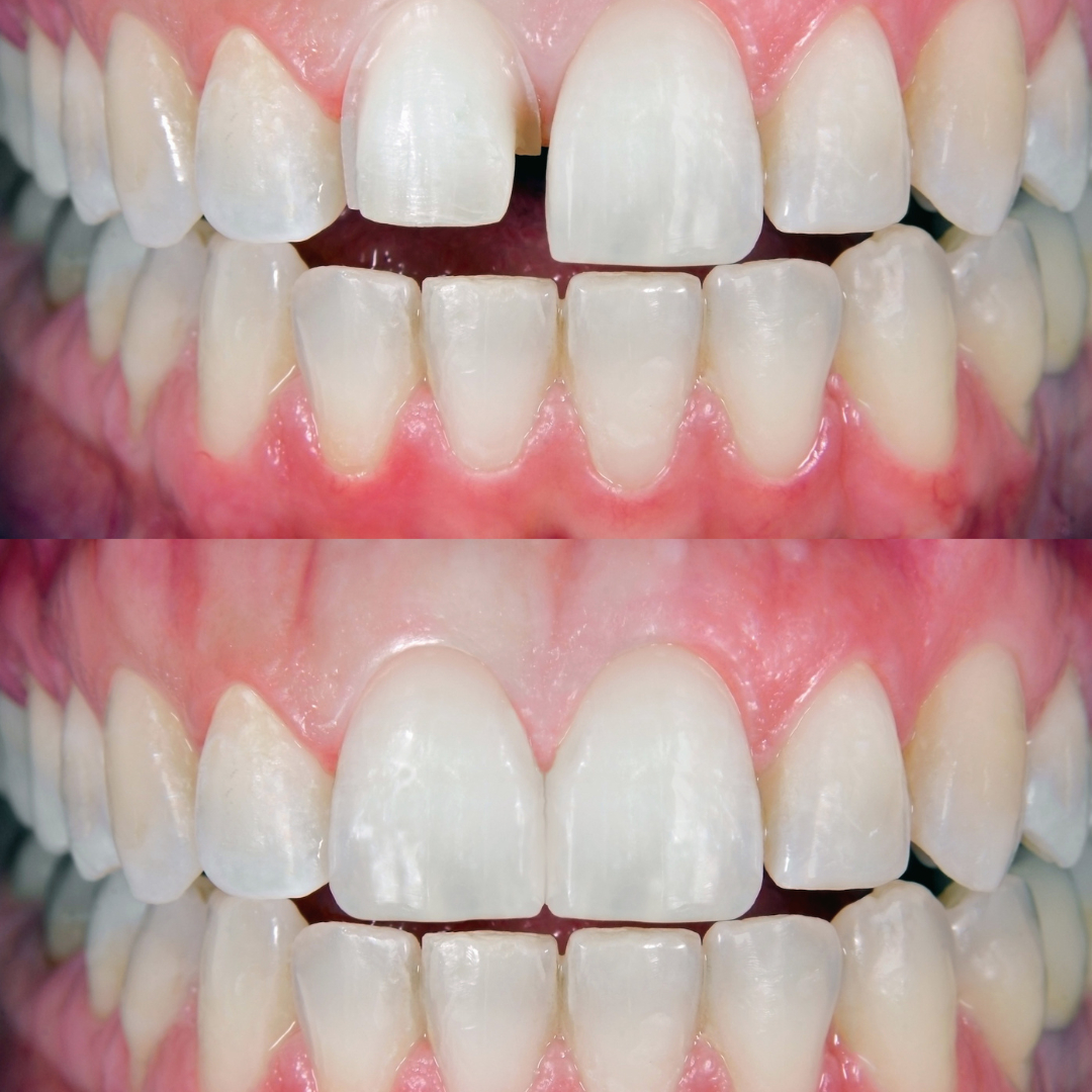 Cosmetic Dentistry & Smile Makeovers – Chingford Mount Dental Practice